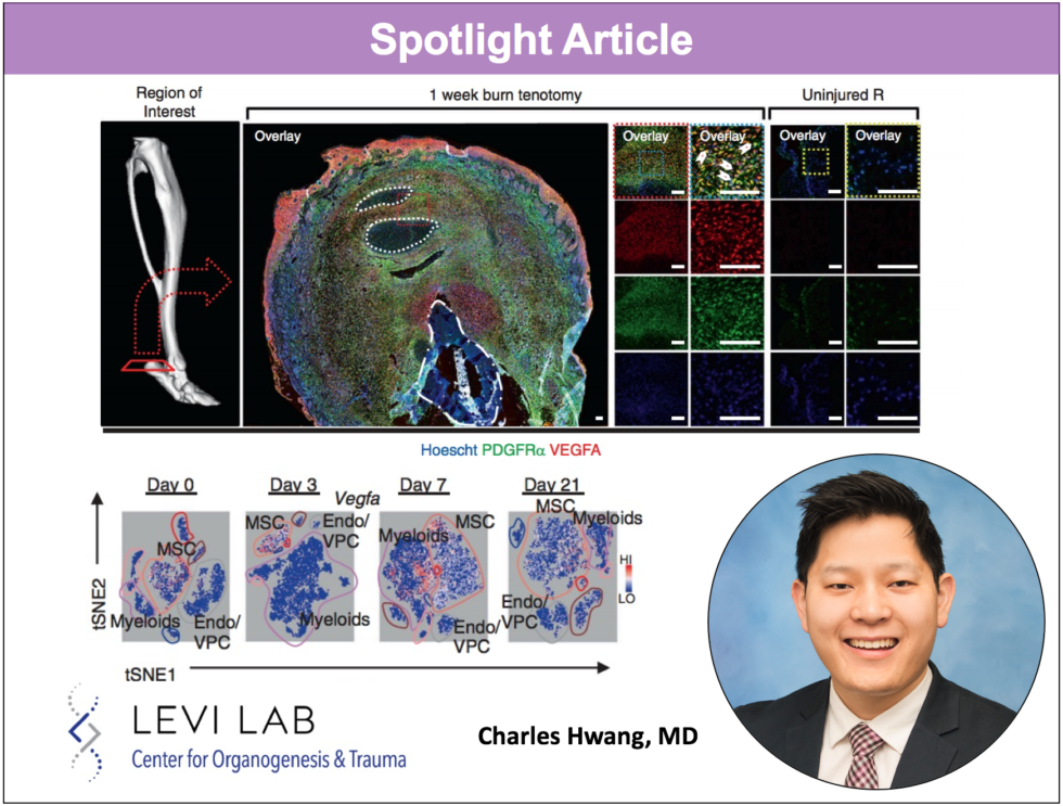 Spotlight Article: Vascular Regulation of Post-traumatic Heterotopic ...